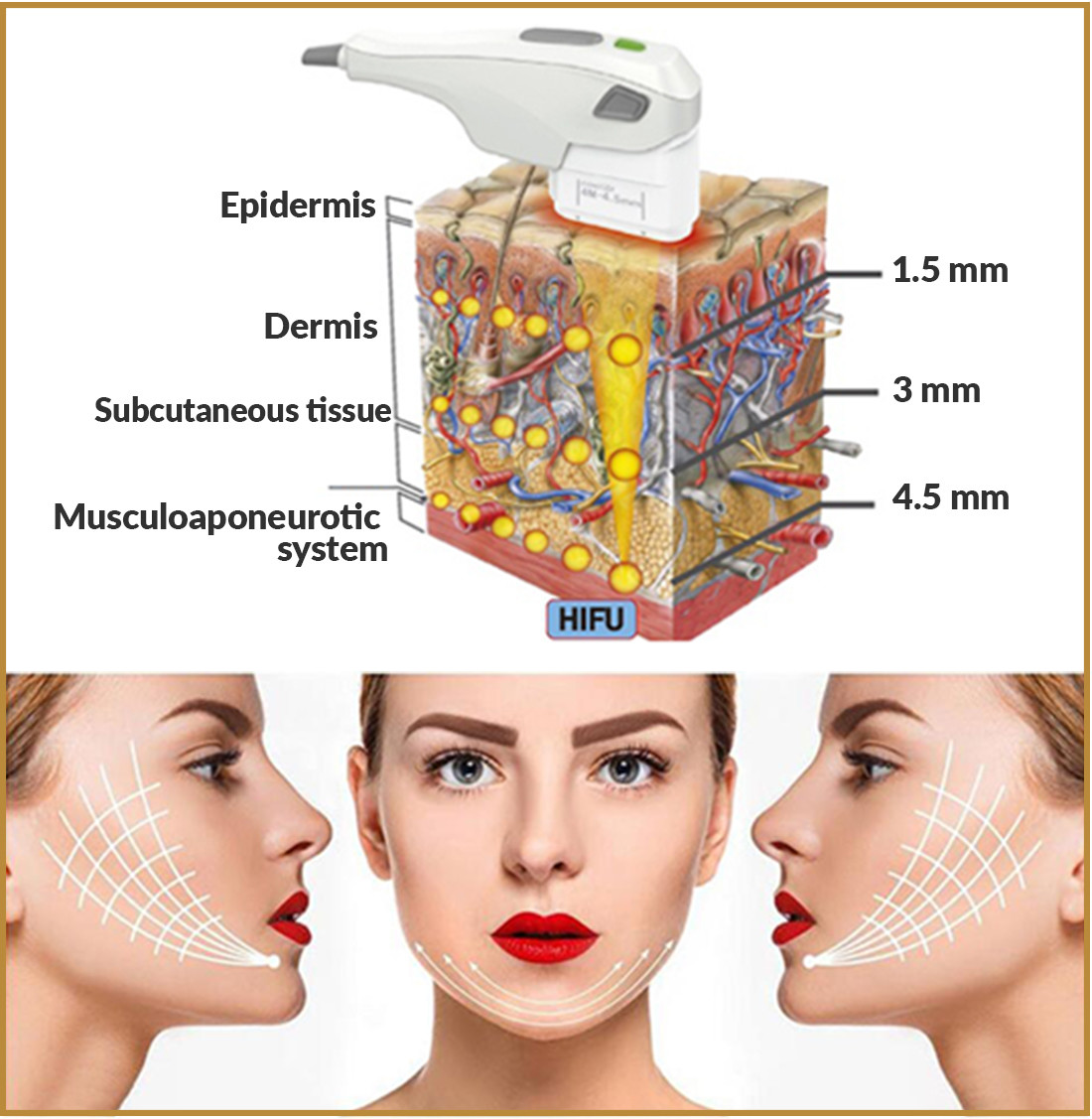 จีน Astiland Medical Aesthetics Technology Co., Ltd ข่าวล่าสุด ...
